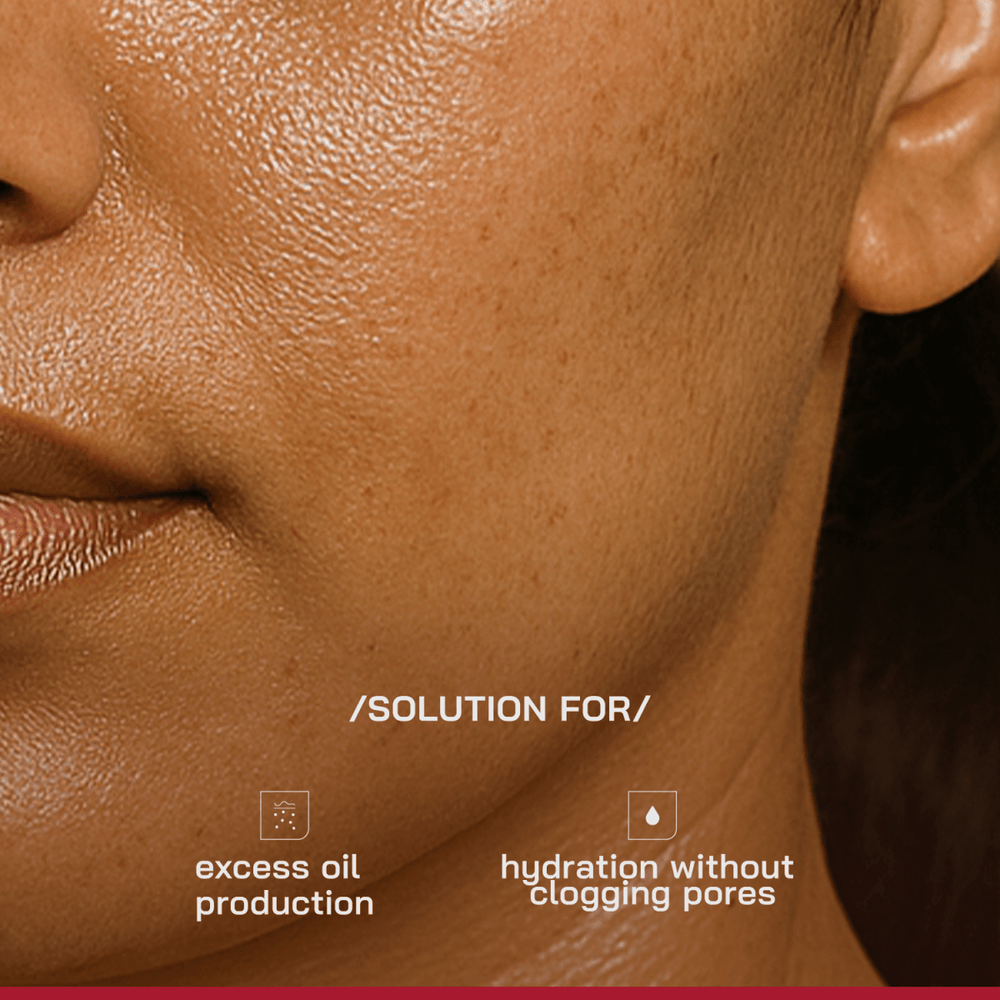 3% Niacinamide Oil-Free Moisturizer for Oily & Acne-Prone Skin